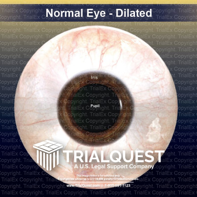 Normal Eye Dilated Trialexhibits Inc