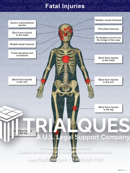 Fatal Injuries - TrialExhibits Inc.